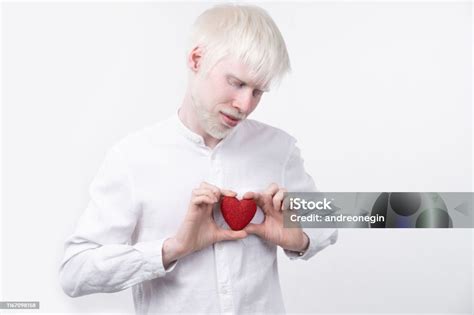 흰색 배경에 고립 된 티셔츠를 입은 스튜디오에서 알비노 남자의 초상화 비정상적인 편차 특이한 외관 20 29세에 대한 스톡 사진