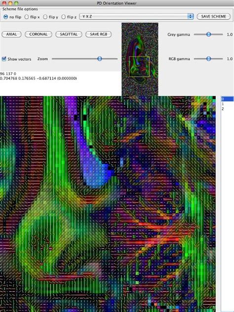 camino tutorial diffusion tensor imaging dti