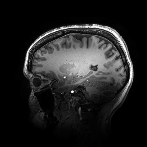 Luca Marciani Posted On Linkedin