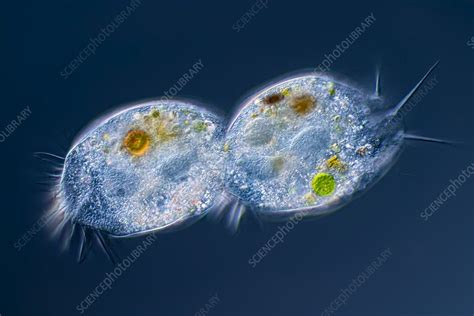 Hypotrich Protozoan Light Micrograph Stock Image C049 3310 Science Photo Library