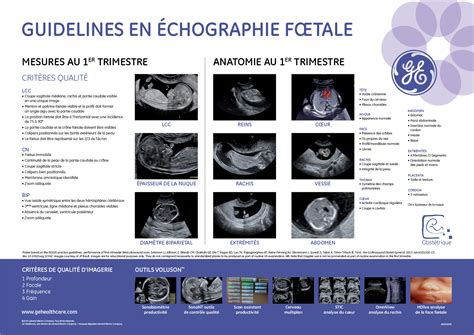 Echographie Fœtale Au 1er Trimestre