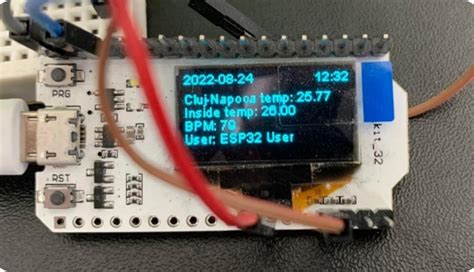 Github Ovimoldovan Healthinfo Diploma Project Using Swift For Ios Watchos And An Esp32