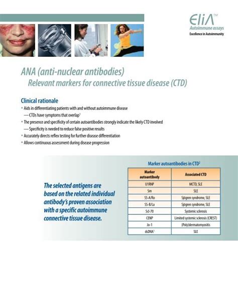 Elia Ana Anti Nuclear Antibodies Phadia