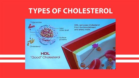 Types Of Cholesterol Youtube