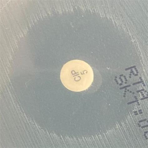 Bacteria Instance Segmentation Model By Labeling Bacterias