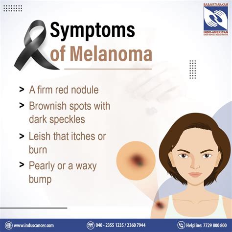 Melanoma And Skin Cancer Causes And Risk Factors Symptoms And