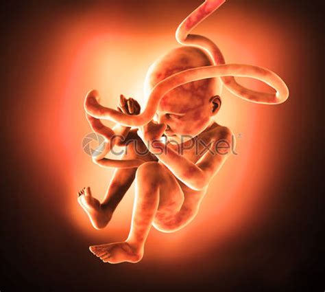 Human Fetus With Umbilical Cord Around The Neck Isolated On Stock