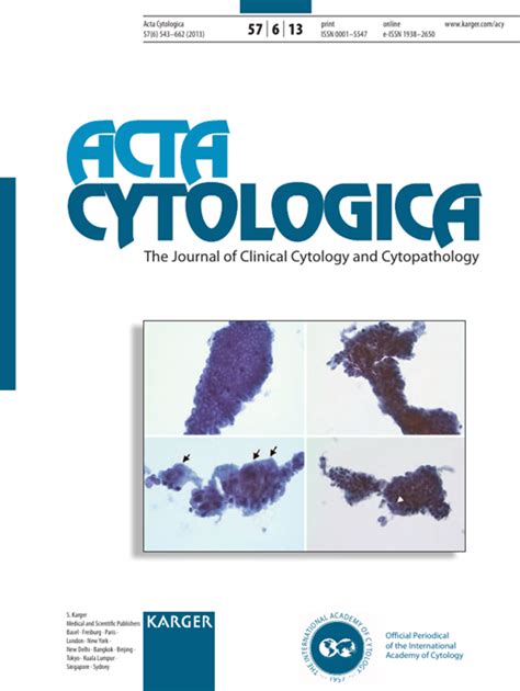 Significance Of Binucleated Cells With Compression In Atypical Squamous