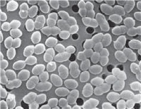 Gambar 80 Vre Vancomycin Resistant Enterococci