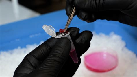 Video Rapid Dissociation Of Tumor Tissue To Gain Enhanced Single Cell