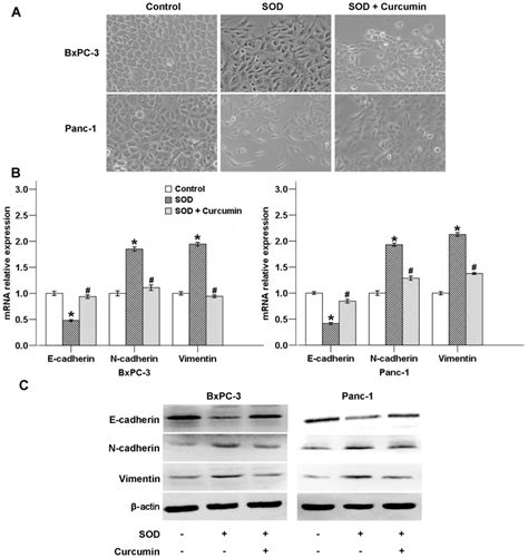Curcumin Inhibits Superoxide Dismutase Induced Epithelial To