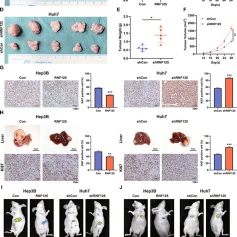 Hcc Proliferation And Metastasis Were Affected By Knockdown And