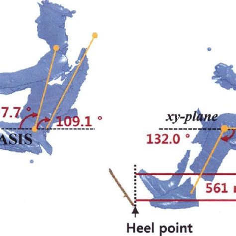 Example Of Driver Postures While Driving For A Long Time Posture A
