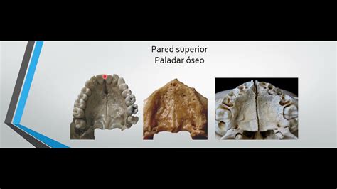 Teórico Cavidad Bucal Paredes Superior y Posterior Anatomía YouTube