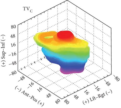 A Differential Histogram Of Target Volume Sizes In 60 Selected