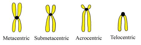 Cytogenetic Karyotypic Abnormalities Focus Dentistry