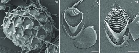 Silica Scaled Chrysophytes In Sem 16 17 Mallomonas Costata 16 The