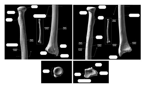 Radius Diagram Diagram Quizlet