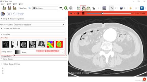 3d Slicer的学习（一）（win10环境）设置3d Slicer Python环境设置 Csdn博客
