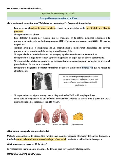 TC de torax apuntes de neumologia Estudiante Kristhie Suárez Landívar Apuntes de