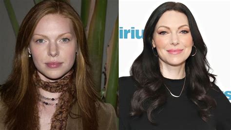 That 70s Show Laura Prepons Plastic Surgery Revealed Rmediamadness