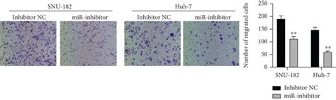 Mir 452 5p Inhibition Suppressed Hcc Cell Migration And Invasion A