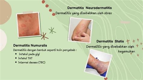 Ppt Dermatitis Pkmpdf