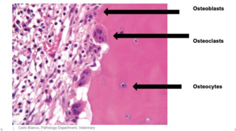 93 Bone Pathology Flashcards Quizlet