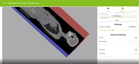 Deploying Healthcare Ai Workflows With The Nvidia Clara Deploy