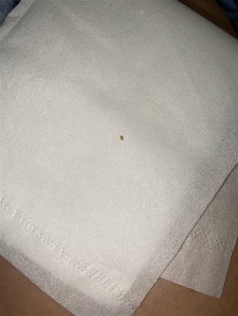 Bed Bug Egg Rbedbugs