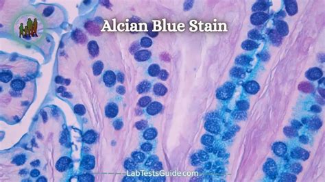 Special Stains A Guide For Histopathologists And Histotechnologists