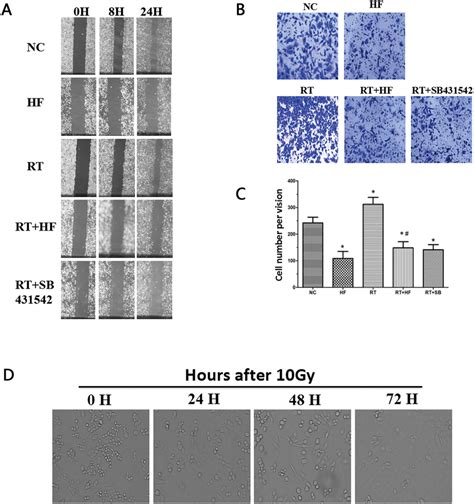 Migration And Wound Healing Assays A Wound Healing Assay To Compare