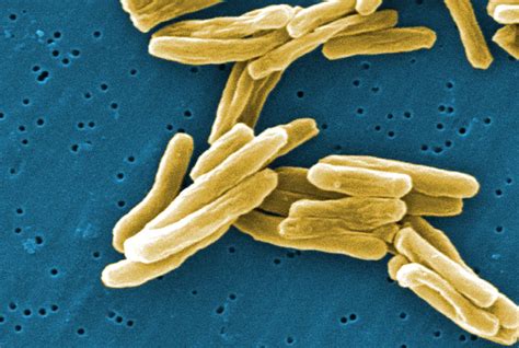 Mycobacterium Tuberculosis Bacterium Britannica