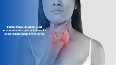Endoscopic Thyroidectomy By Dr Ram Khare Navi Mumbai