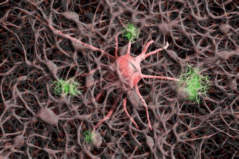Free Nerve Cell Brain Images Pixabay