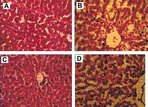 A D Assessment Of Ccl 4 Induced Hepatotoxicity By Histopathology In