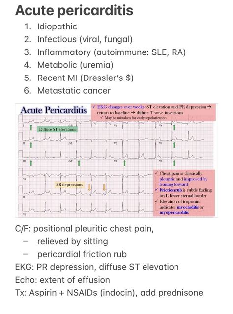Ecg Interpretation Review 47 Normal Variants Early Repolarization