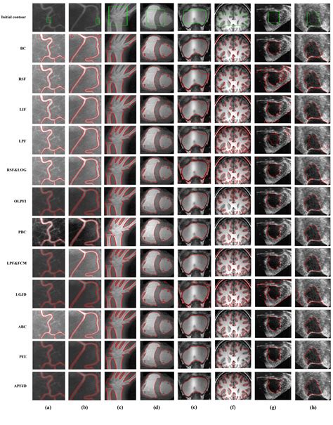 An Overview Of Intelligent Image Segmentation Using Active Contour Models