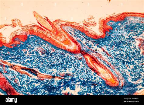 Scalp With Hair Roots Tissue Under The Microscope 100x Stock Photo Alamy