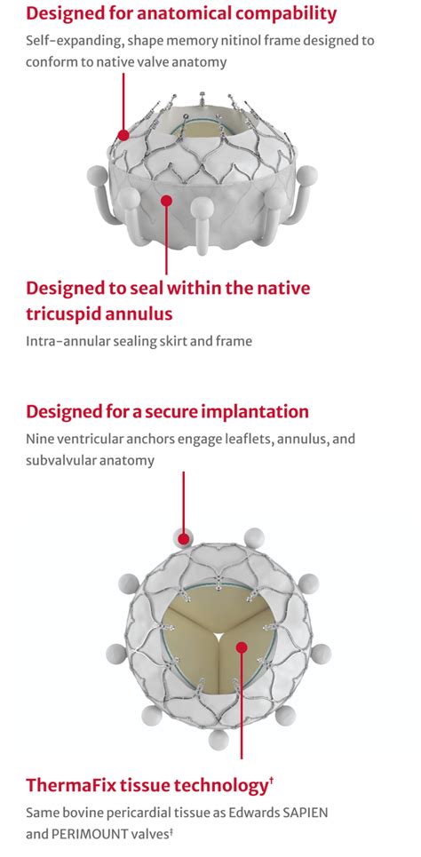 Evoque Tricuspid Valve Replacement Edwards Lifesciences