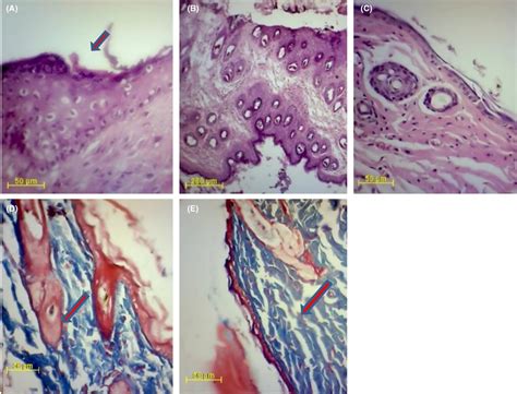 HematoxylinEosin Staining Histological Images On The A Control