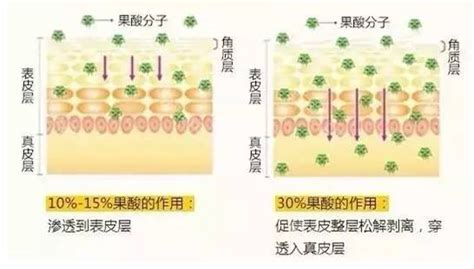 为什么要去角质？去角质有什么好处？ 知乎