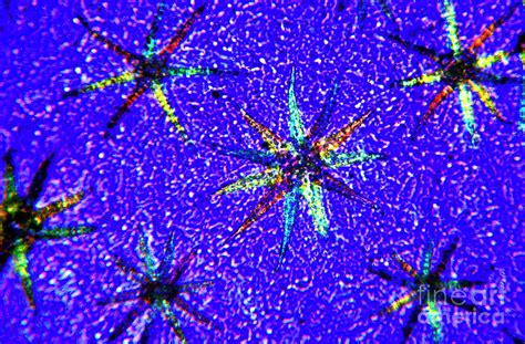 Stellate Leaf Hairs Photograph By Dr Keith Wheelerscience Photo