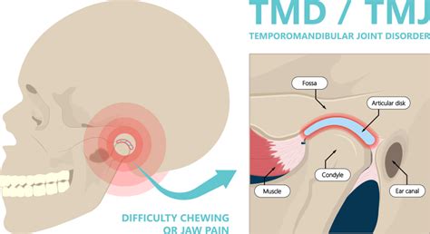 Tmj Innovative Physical Therapy And Fitness Center