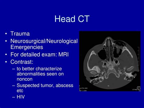 Ppt Ordering Radiological Exams Powerpoint Presentation Free