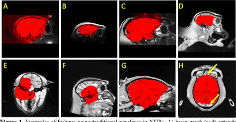 Figure 1 From U Net Model For Brain Extraction Trained On Humans For