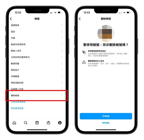 Ig 新增「刪除帳號」選項，告訴你跟停用帳號差在哪，也教你怎麼做 蘋果仁 果仁 Iphoneios好物推薦科技媒體