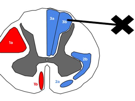 Anatomia Da Medula Espinal Marrony Monitor De Anatomia Quizur