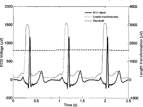 figure 2 4 from the fetal electrocardiogram determination of the fetal