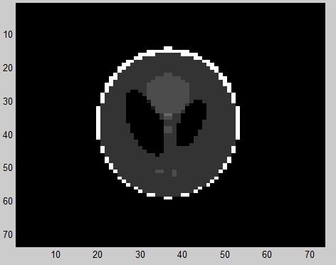 Image Rotation By Matlab Without Using Imrotate Stack Overflow